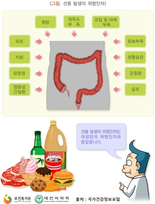 선종성 용종 대장암과의 관계 네이버 블로그